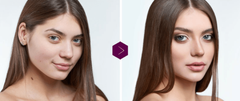 Tip Plasty : Things you need to consider - Seoul Guide Medical